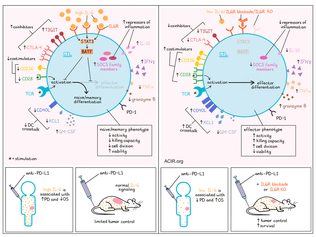 IL-6 blockade could enhance PD-L1 immunotherapy