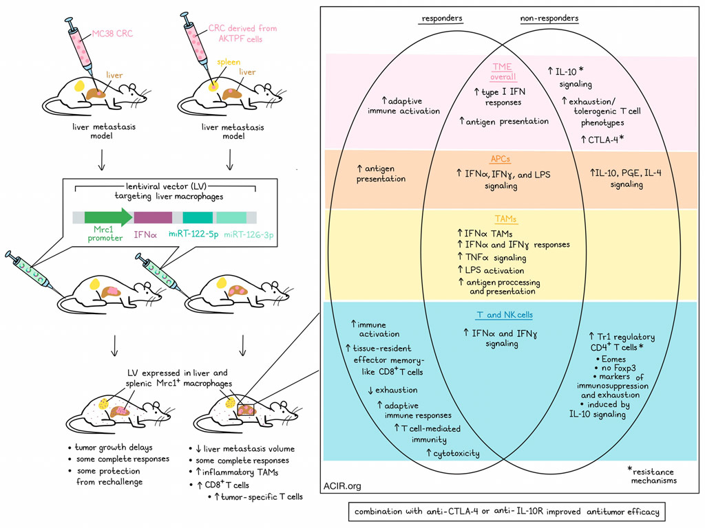 Manipulated macrophages reshape the metastatic tumor microenvironment