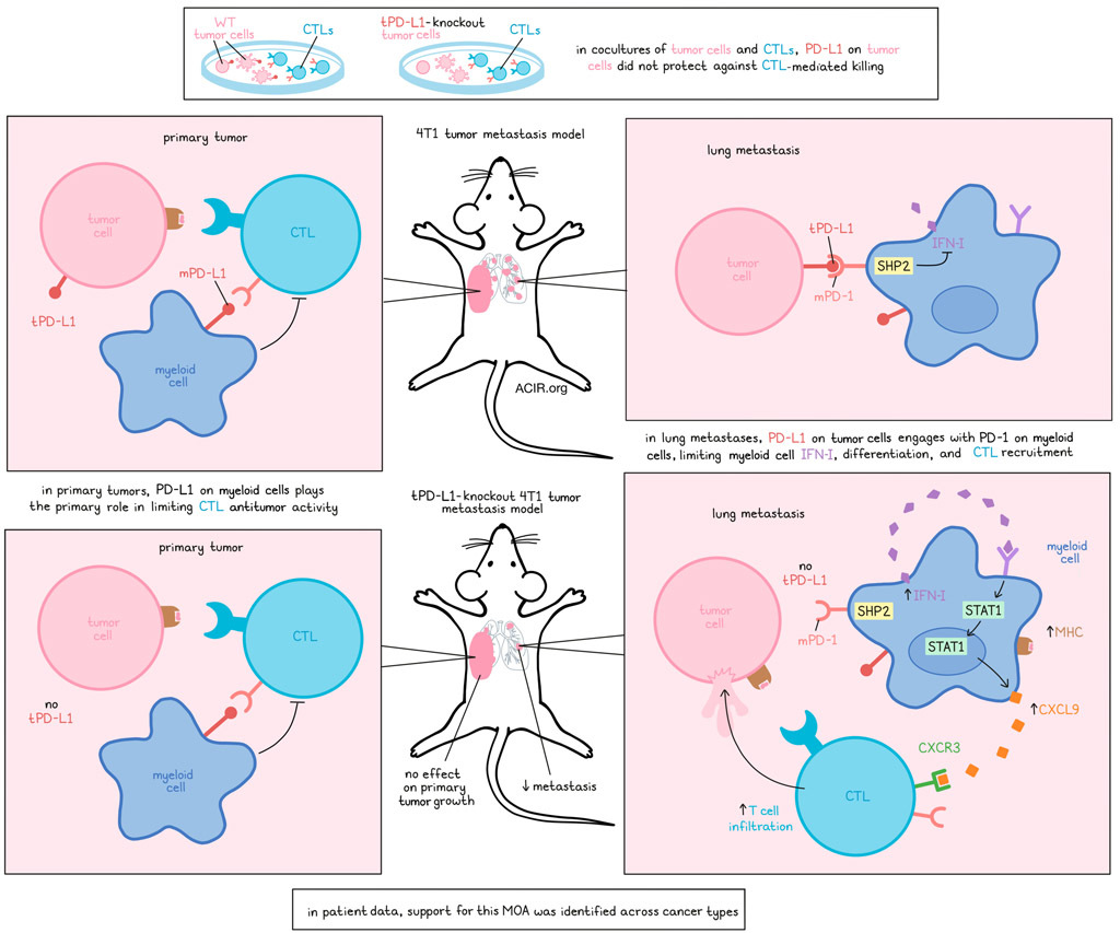 Tumor PD-L1 promotes metastasis through a myeloid middle man Tumor PD-L1 promotes metastasis through a myeloid middle man
